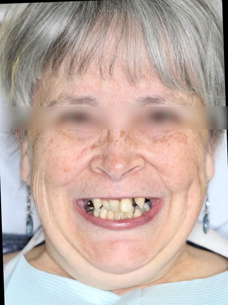 Smile Makeovers Before & After In Guelph ON | Scottsdale Dental Centre